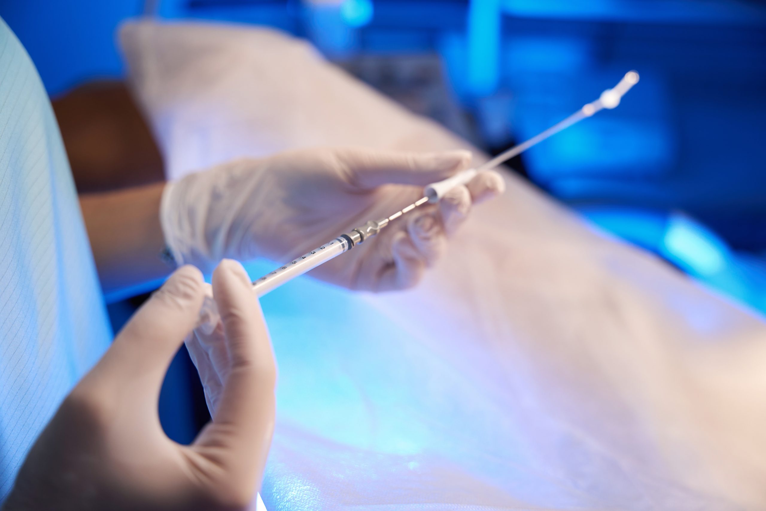 Embryo Transfer Procedure in IVF | Step-by-Step Guide
