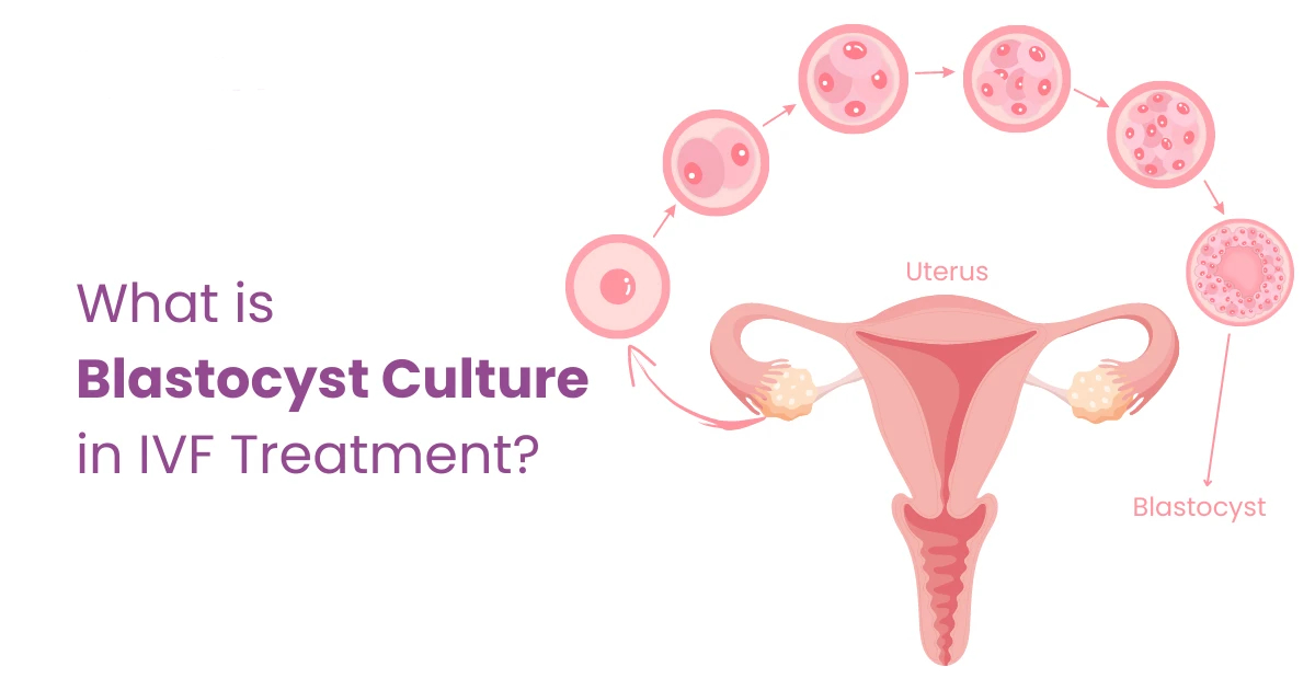 Blastocyst Culture – Genesis Ivf